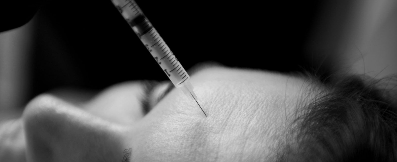 What you need to know about fillers and their longevity