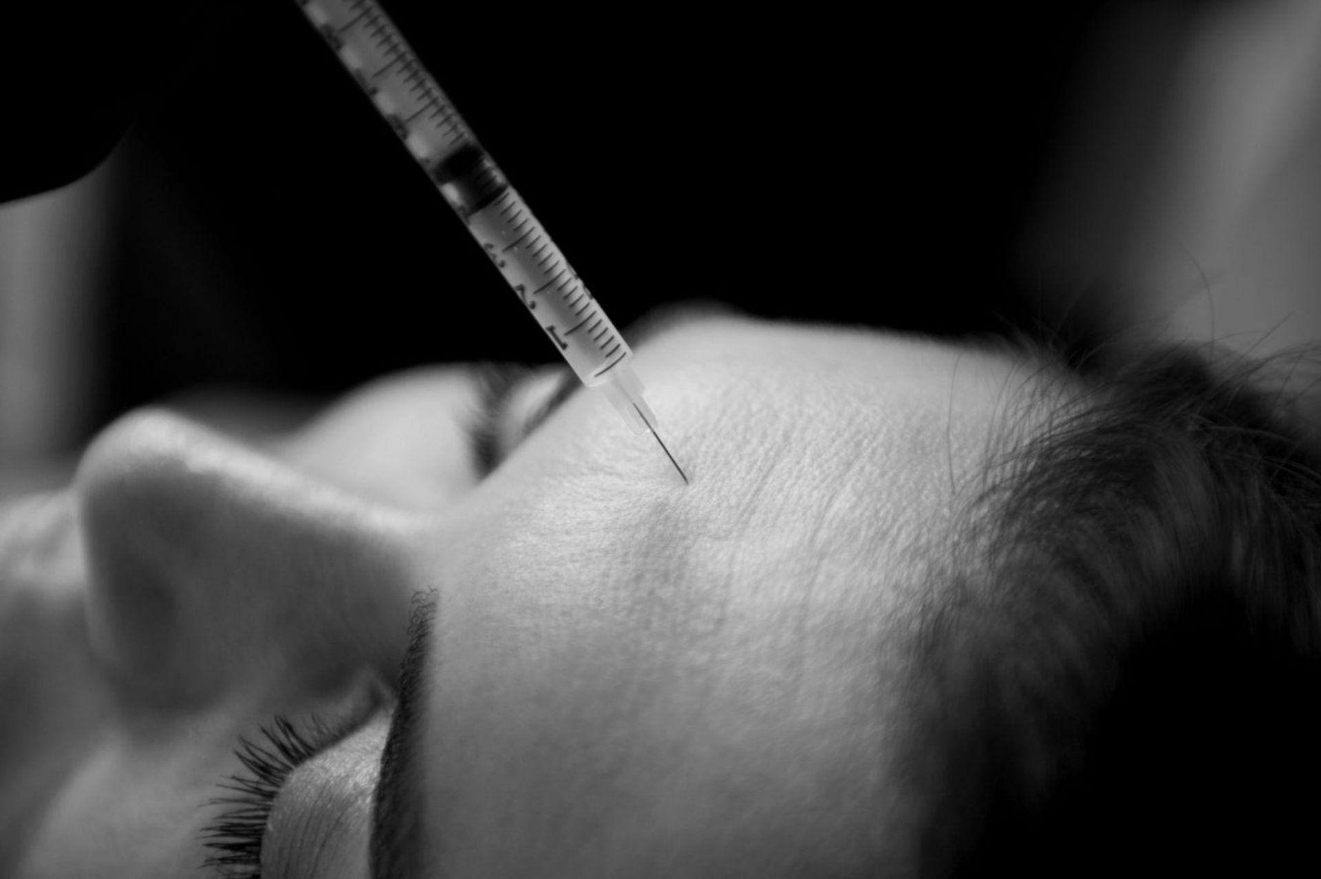 The longevity of fillers: What to know about making them last longer